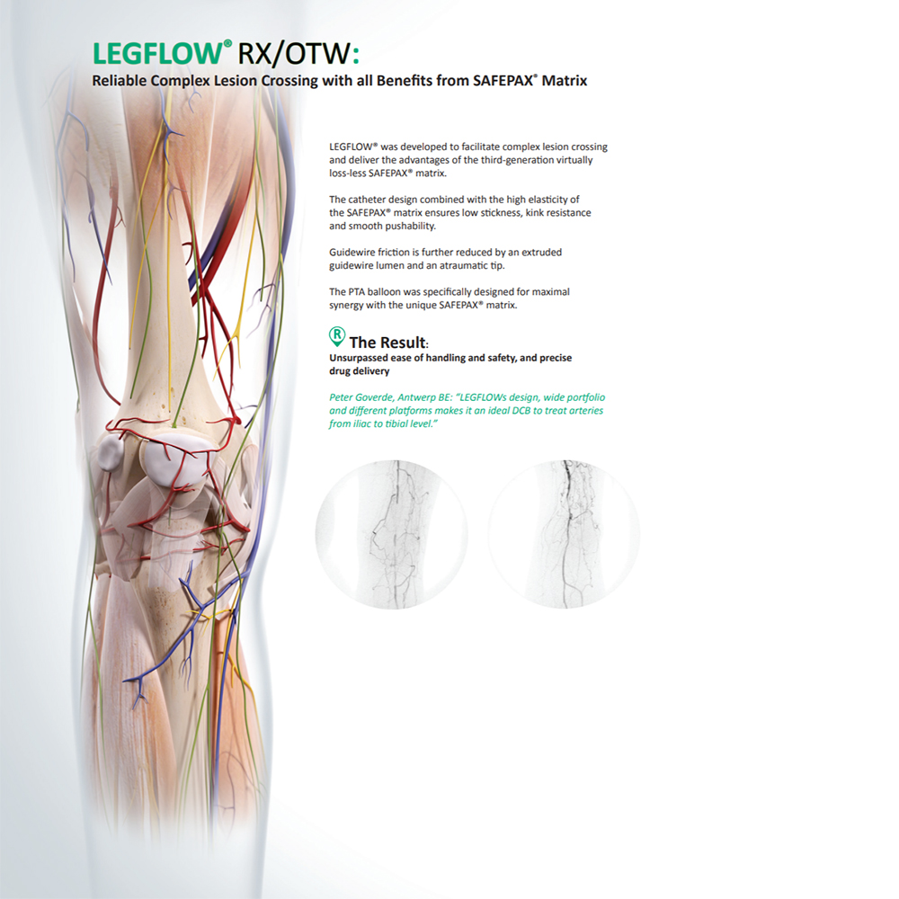 LEGFLOW RX/OTW® | Stellar Medical