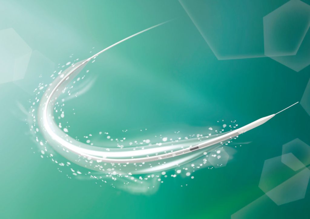 RESTORE DEB® | Stellar Medical